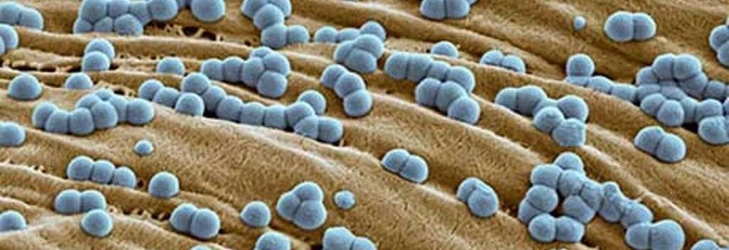 Antimicrobial finishing on Textiles - Textile Research and Development